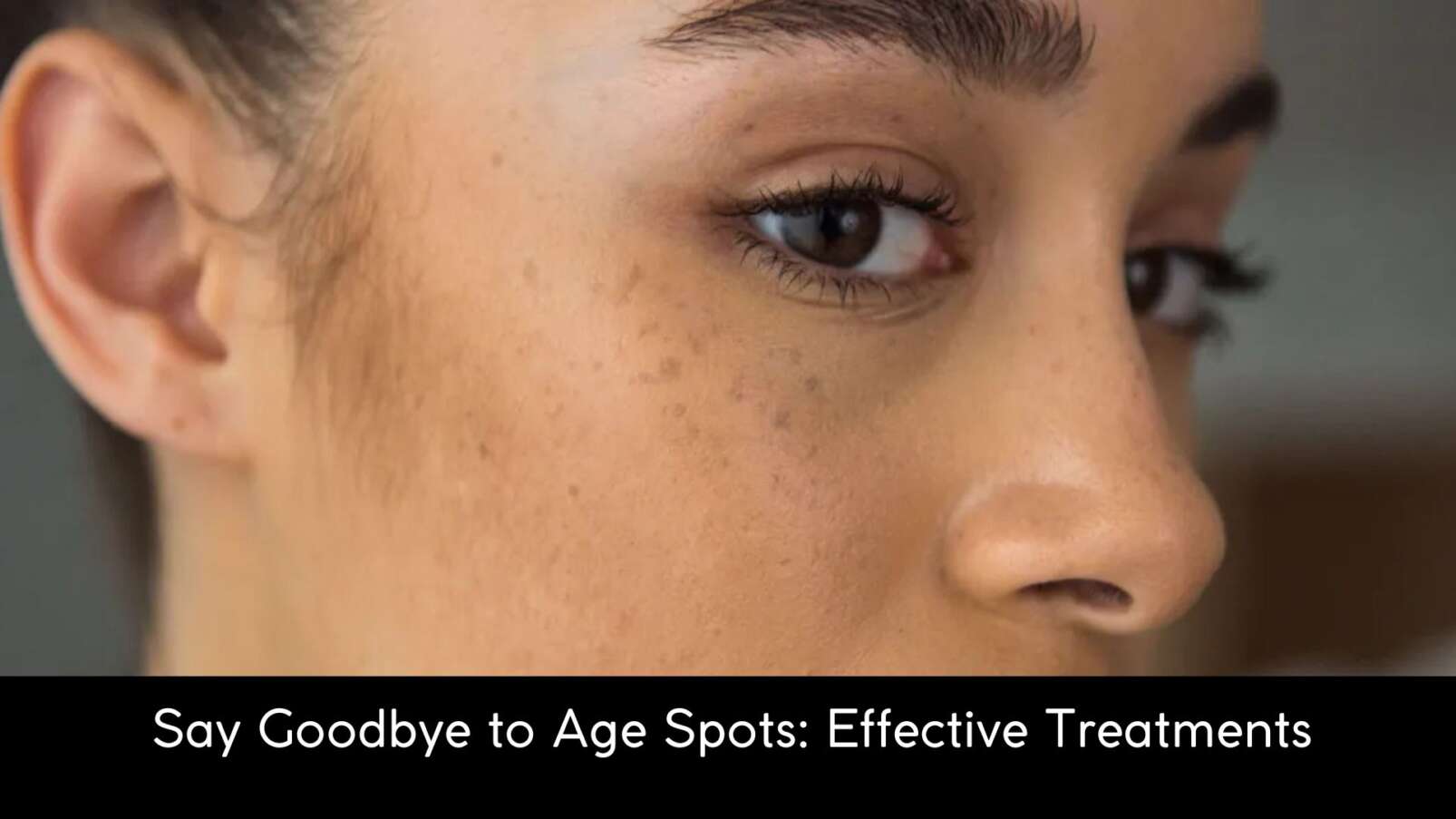 Say Goodbye to Age Spots: Effective Treatments