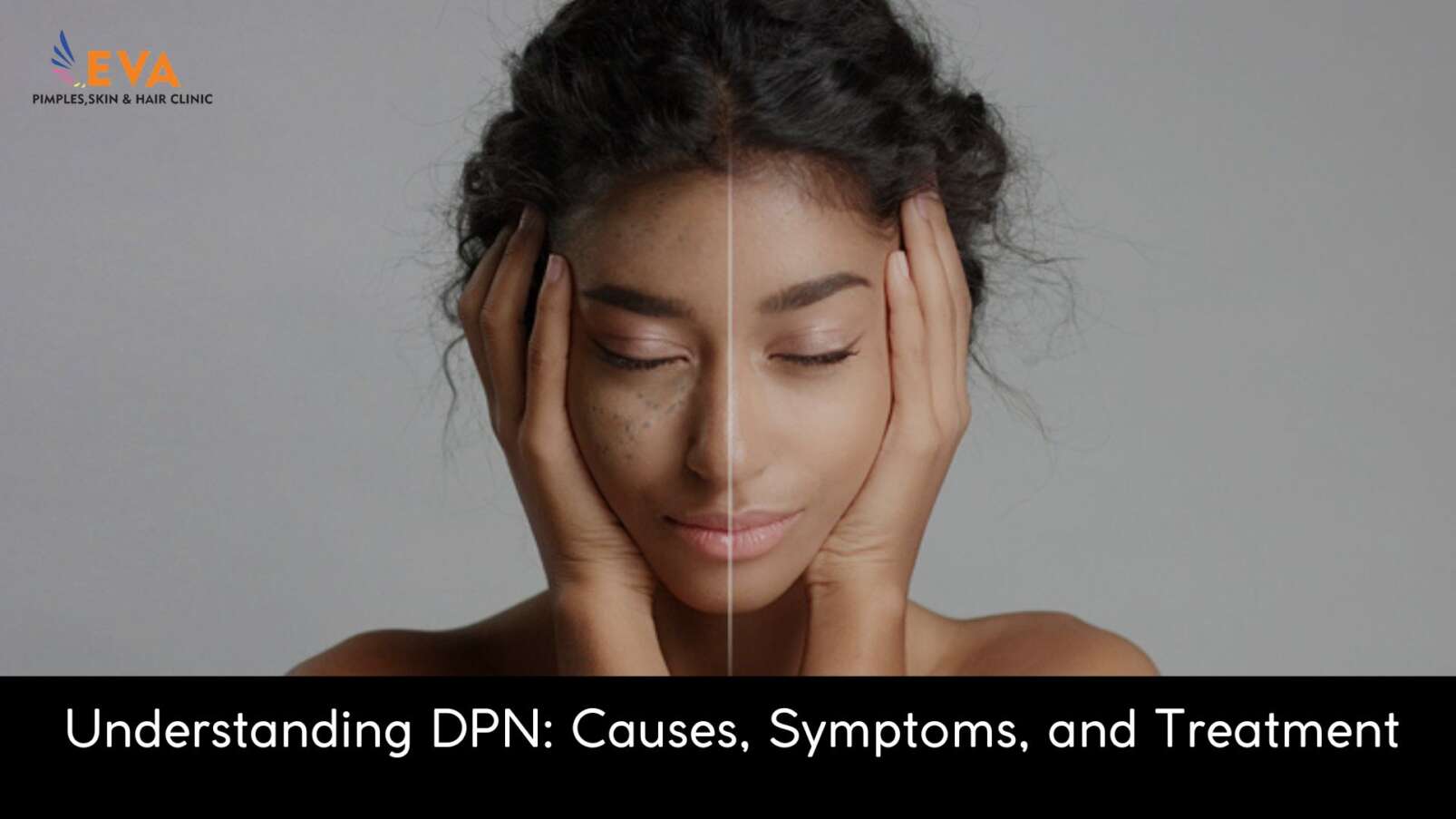 Understanding DPN: Causes, Symptoms, and Treatment