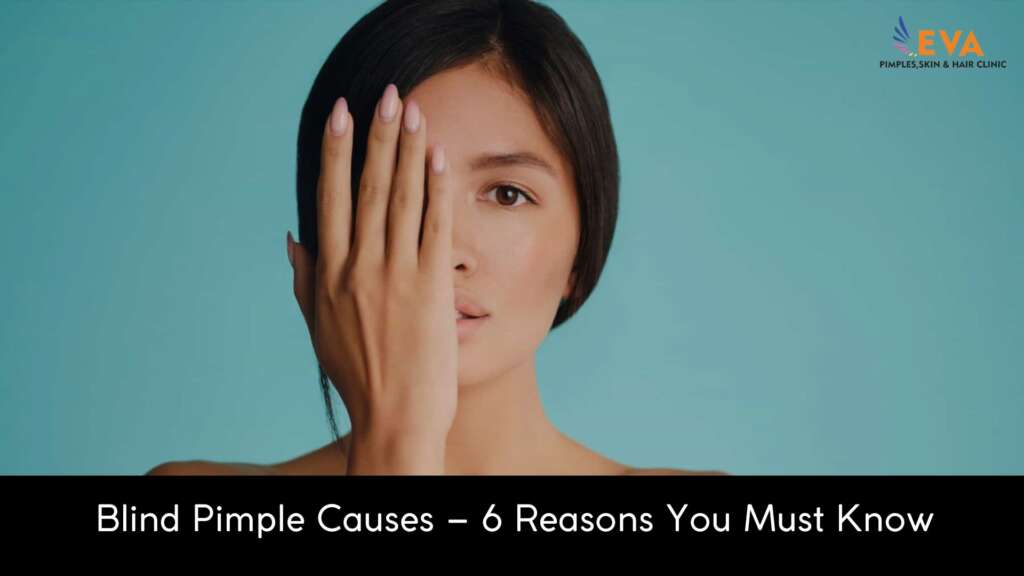 Blind Pimple Causes: 6 Key Triggers